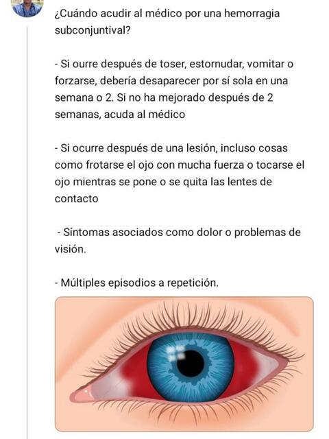 HEMORRAGIA CONJUNTIVAL | Enfermero Isaias Rivas | uDocz