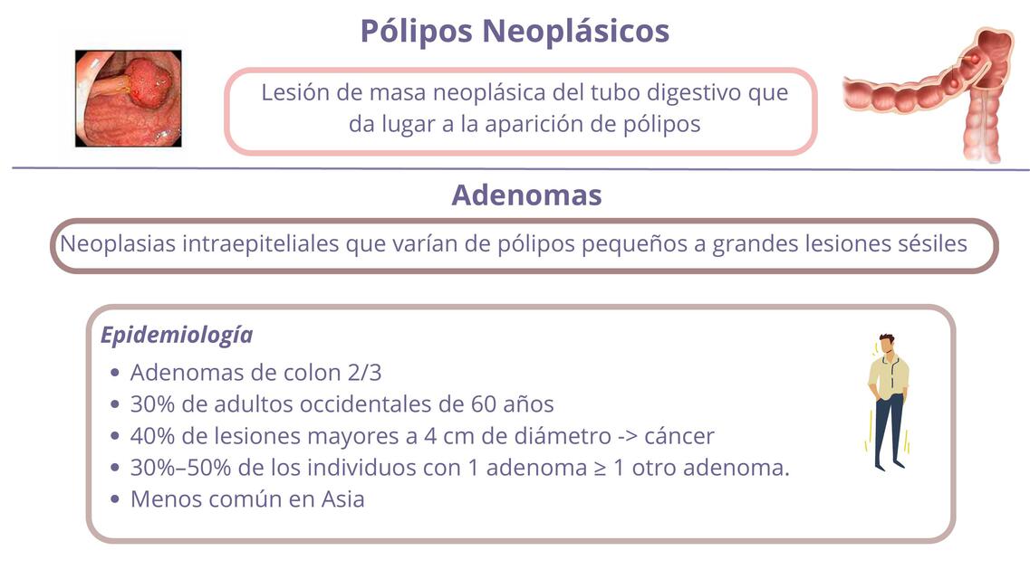 Pólipos Neoplásicos | Ana Fernanda Zhindon Macas | uDocz