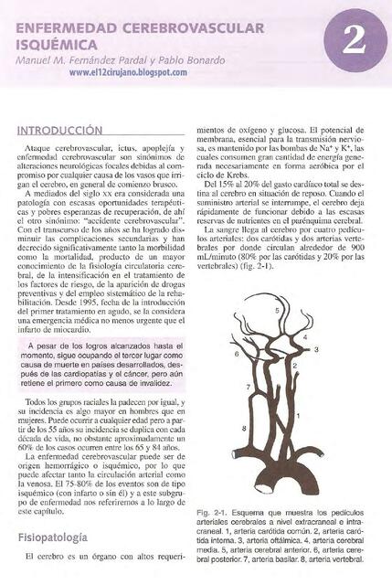 Enfermedad Cerebrovascular Isquémica | Ramiro Agustin Flores Platero | uDocz