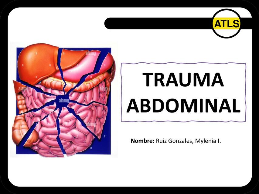 Trauma Abdominal | Mylenia Ruiz Gonzales | uDocz