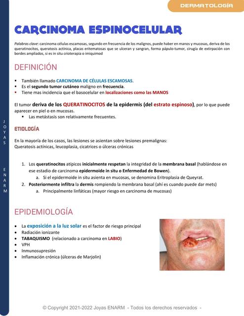 Carcinoma Espinocelular | Medicina Humana | uDocz