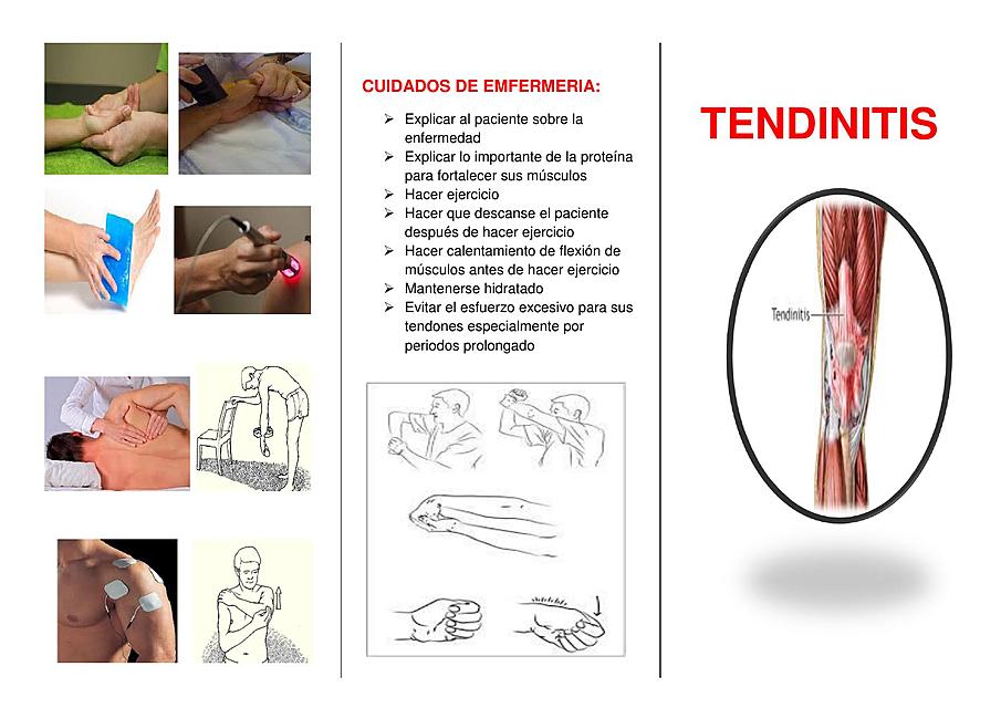 tendinitis triptico | Oscar Solorzano Samame | uDocz