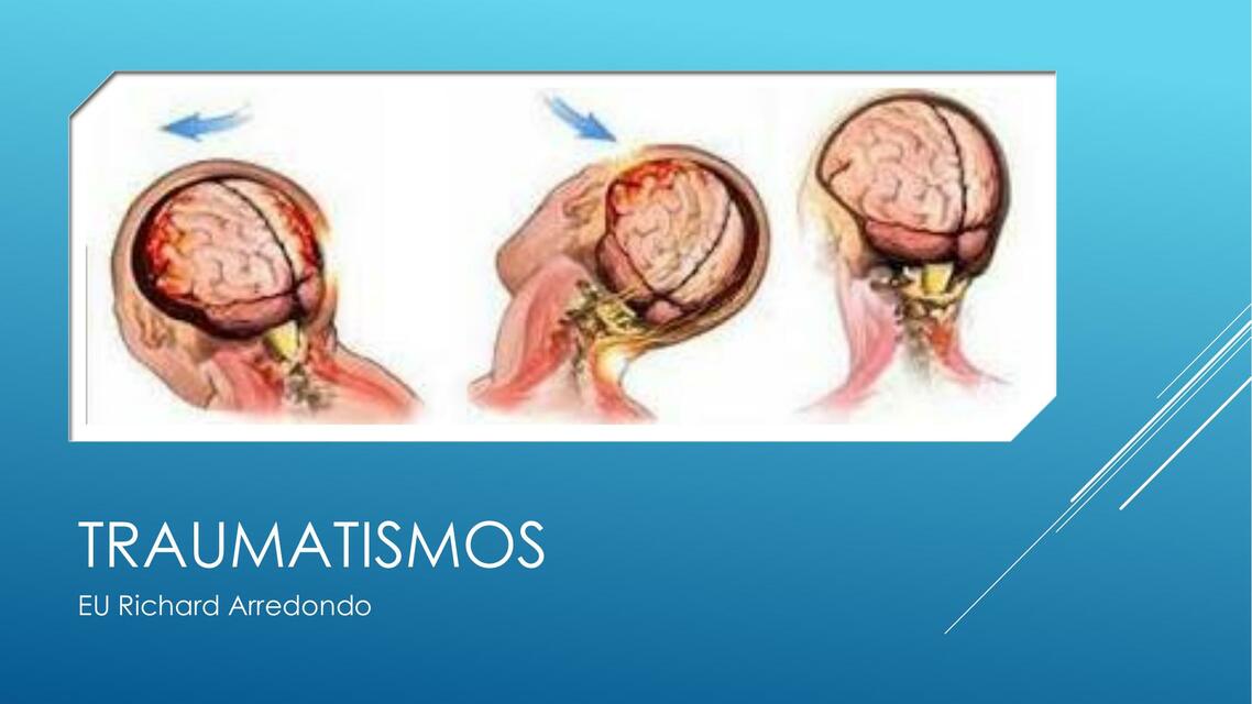 Clase 2 Traumatismos | Daniela | uDocz