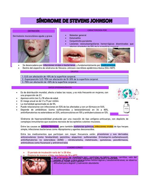 Síndrome de Stevens Johnson | Jennifer Diaz | uDocz