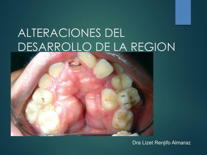 Resúmenes de Anodoncia | Descarga apuntes de Anodoncia