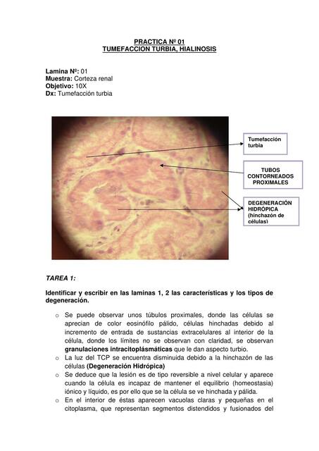 Tumefacción turbia y Hialinosis | CIENCIAS DE LA SALUD | uDocz