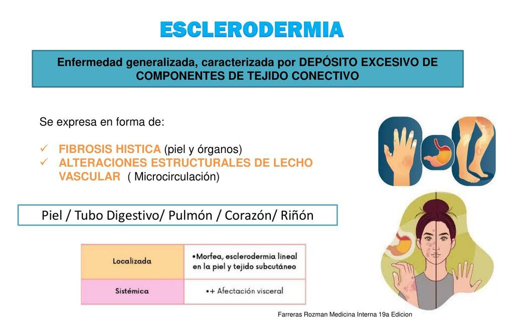 Esclerodermia | Escuela medica | uDocz