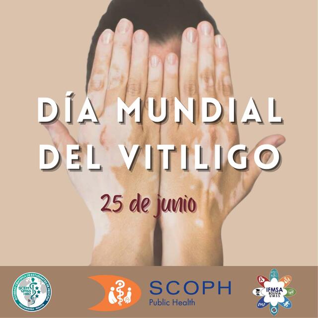 Vitiligo | SCEM-UMSS Bolivia | uDocz
