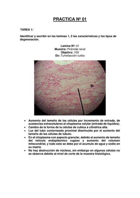 Tumefacción turbia | CIENCIAS DE LA SALUD | uDocz