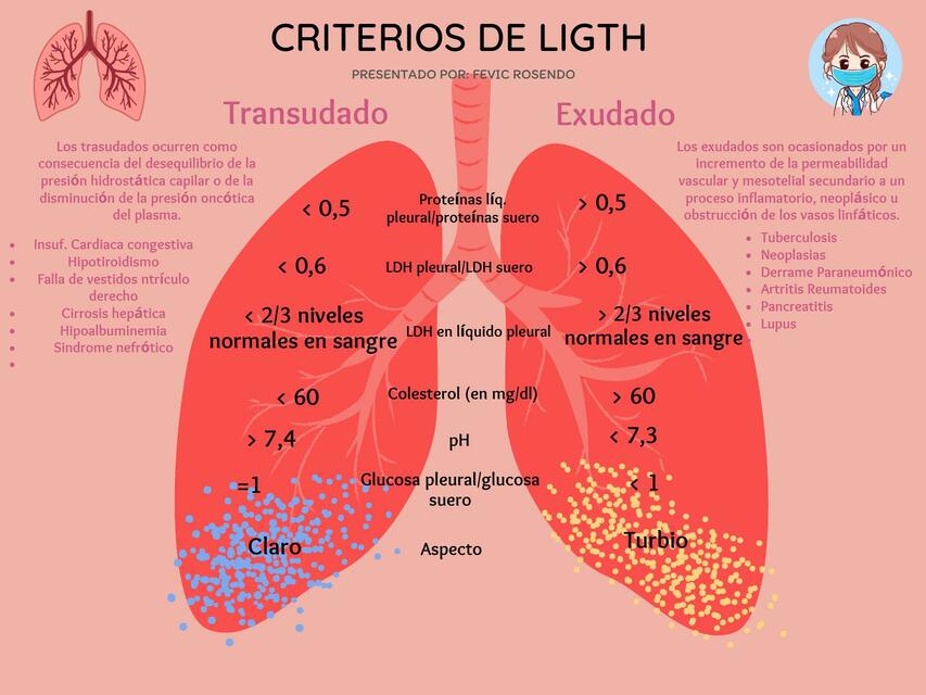 Criterios de Ligth | Fevic Rosendo | uDocz