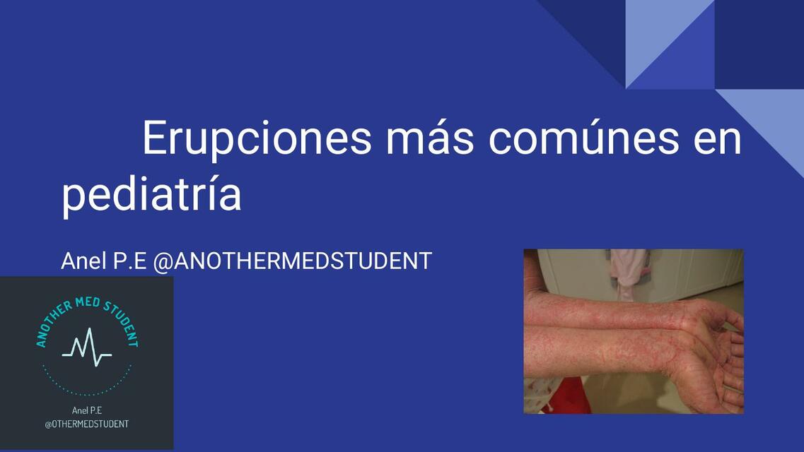 Erupciones más comunes en pediatría | Anel P.E. ANotherMedStudent | uDocz