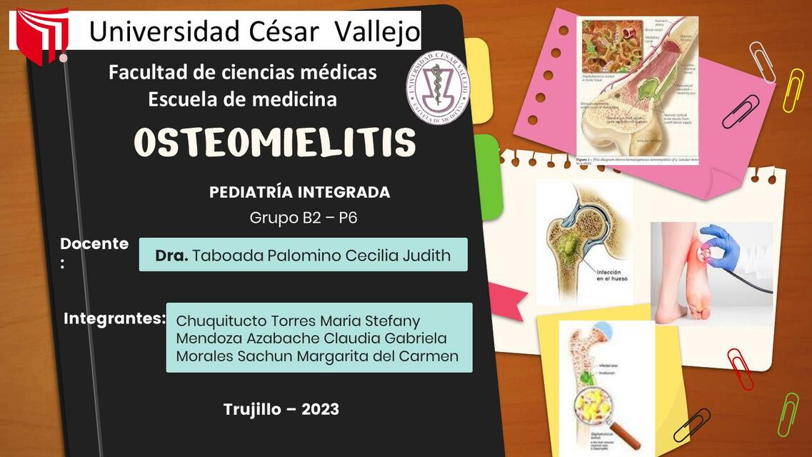 Osteomielitis | Maria Stefany Chuquitucto Torres | uDocz