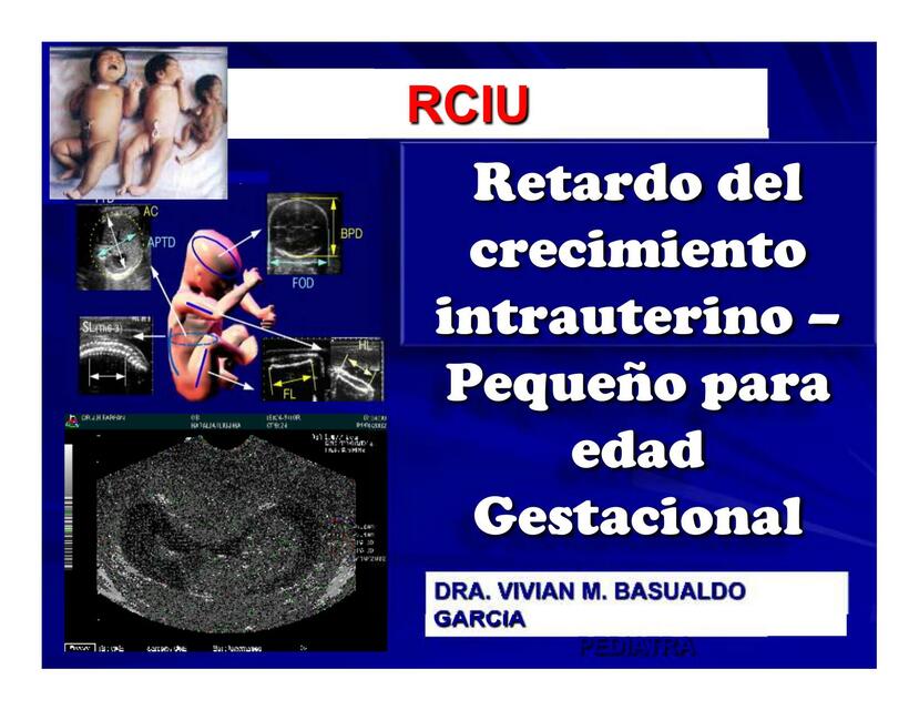 Retardo del Crecimiento Intrauterino | Mishelle Chavez | uDocz