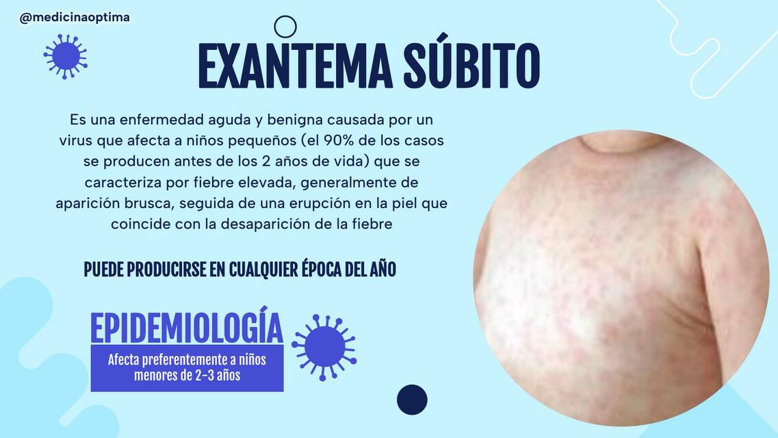 Exantema súbito | Medicina Óptima | uDocz