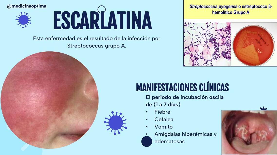 Escarlatina | Medicina Óptima | uDocz