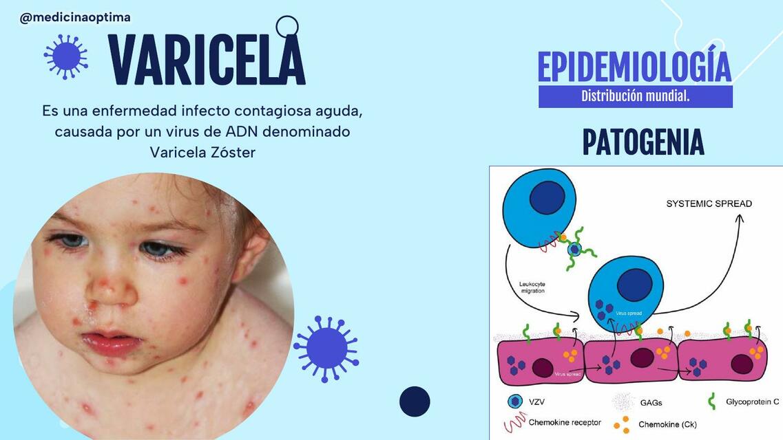 Varicela | Medicina Óptima | uDocz