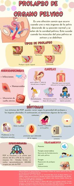 Prolapso de órgano pélvico | karen dayana yusti guevara | uDocz