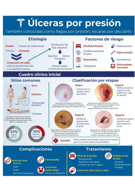 Úlceras por Presión | uDocz