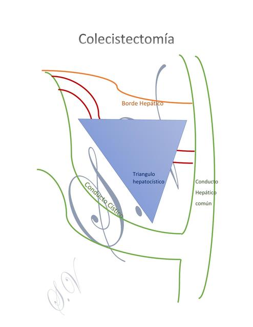 Colecistectomía | sandra cruz | uDocz