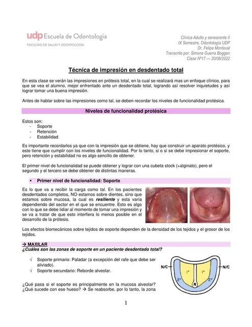 Técnica de impresión en desdentado total | DENISSE ANDREA OLAECHEA ...