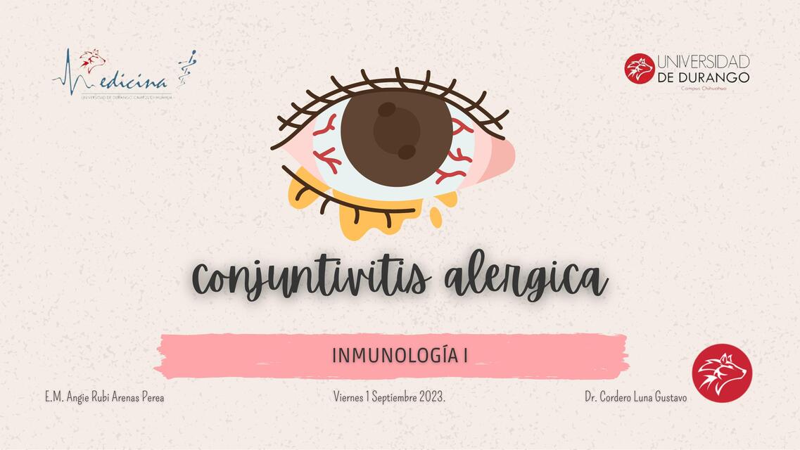Conjuntivitis alérgica y pénfigo | JOSE | uDocz
