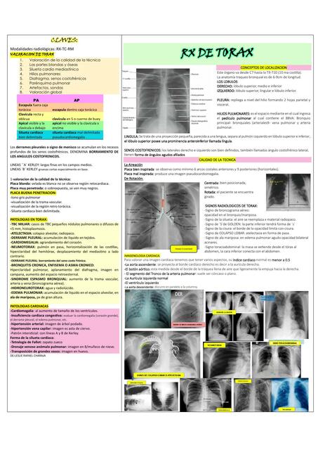 RX de Tórax | LESLIE ELIZABETH RAFAEL CHARAJA | uDocz