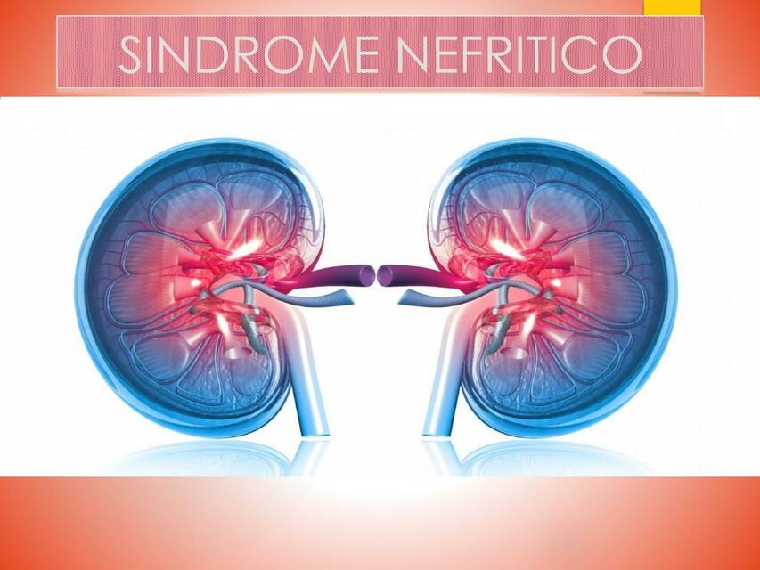 Síndrome nefrítico | Escuela medica | uDocz