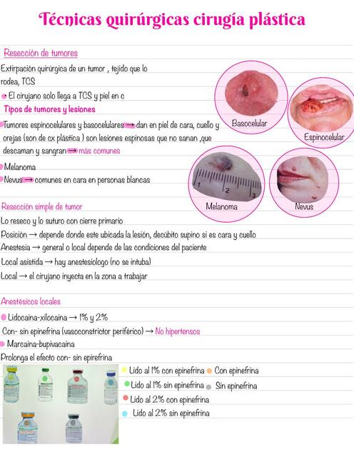 Resección de tumores-cirugía plástica | laurav98o | uDocz