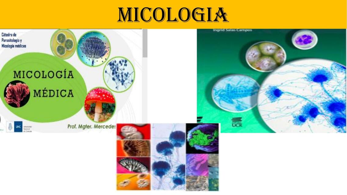 Generalidades en Micología Clínica | Karol Calderon Cajaleon | uDocz