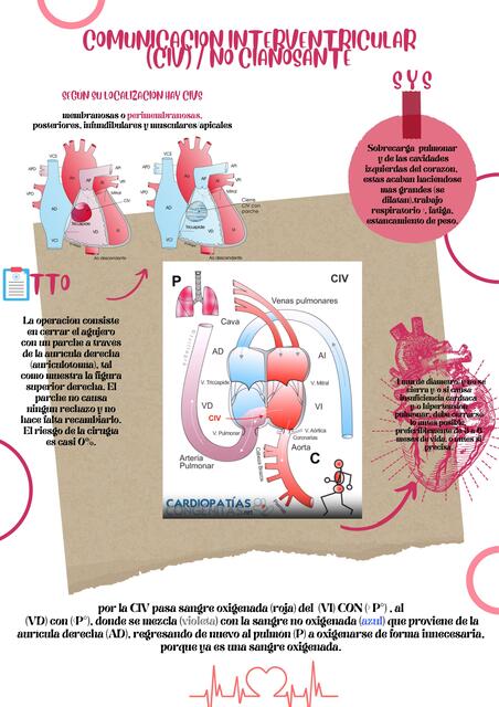 Comunicación Interventricular | Marisol Erazo | uDocz