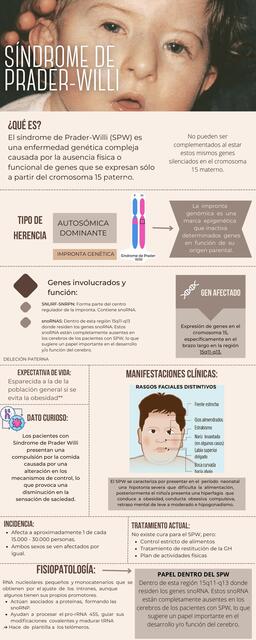 Síndrome de prader - willi | Denisse Téllez | uDocz