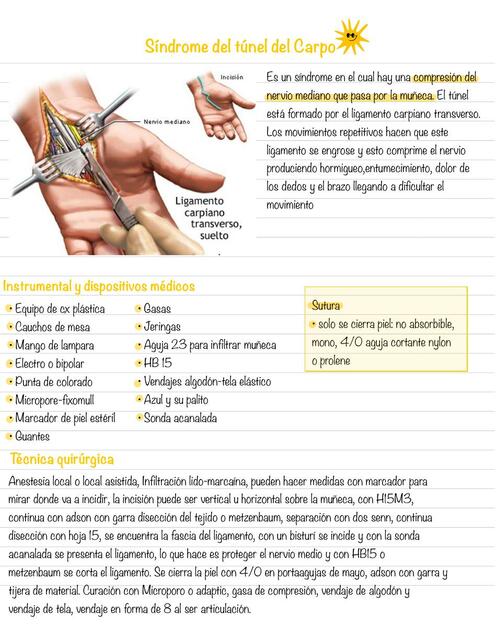 Síndrome del túnel del carpo | laurav98o | uDocz