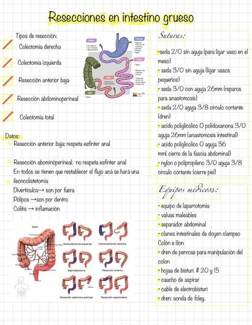 Resecciones de intestino grueso | laurav98o | uDocz