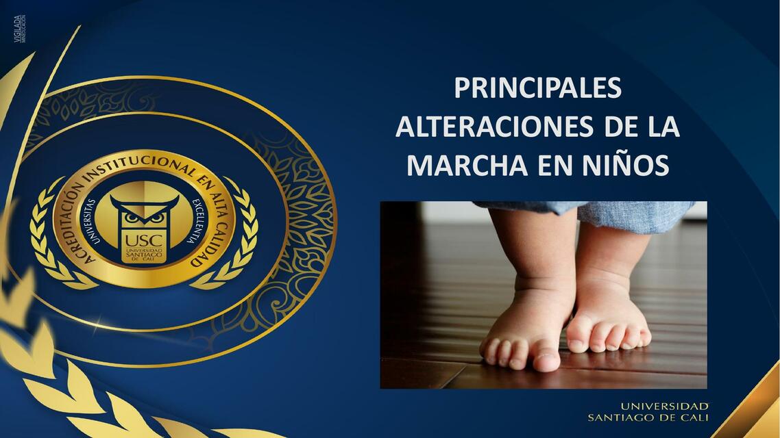 Principales Alteraciones de la Marcha en Niños | Valeria Meji | uDocz