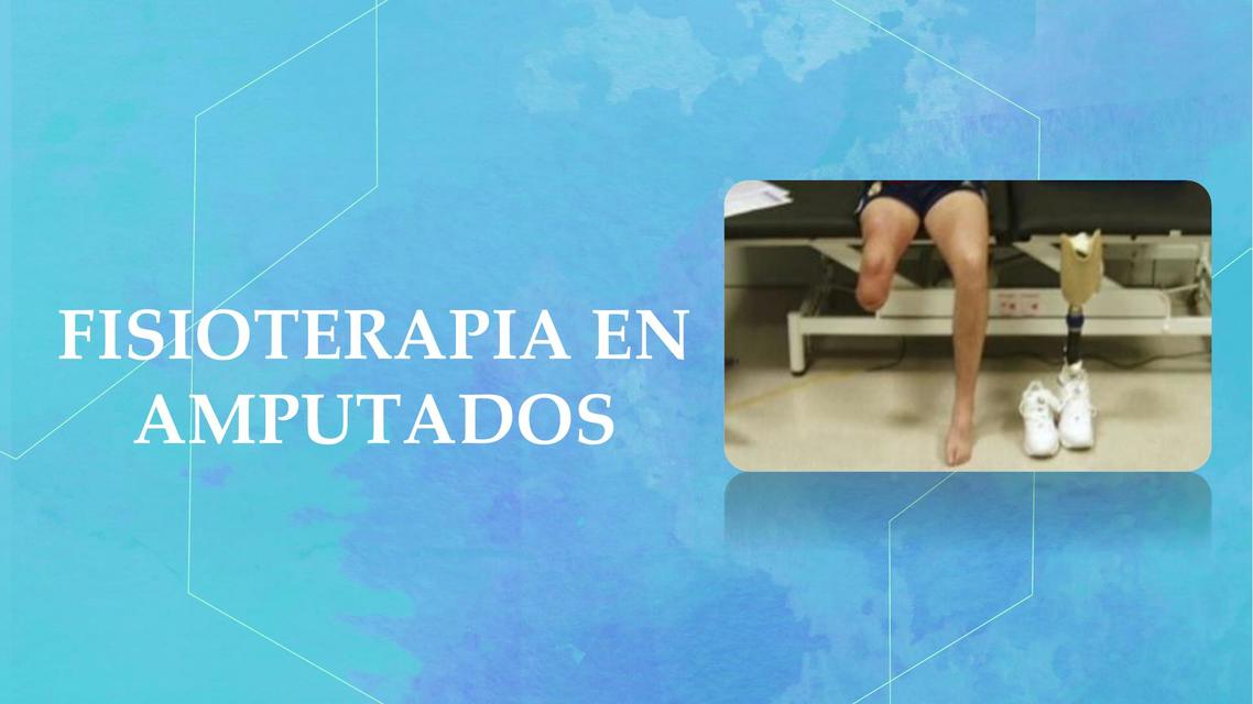 REHABILITACION EN LA AMPUTACION, HISTORIA Y ETIOLOGIA