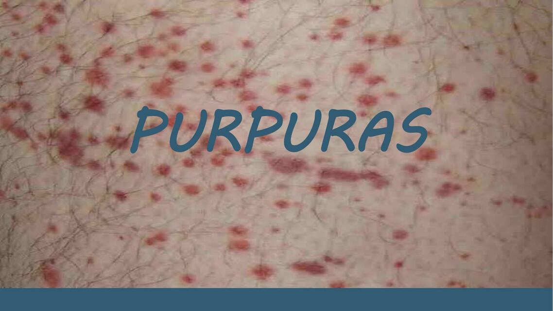 Purpuras | uDocz