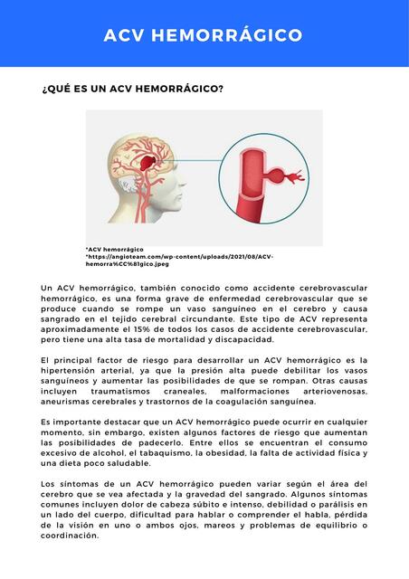ACV hemorrágico | Facilitando tu estudio | uDocz