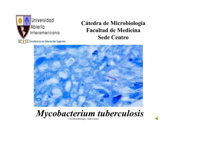 Mycobacterium tuberculosis | Sergio Calderaro | uDocz