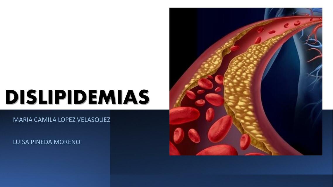 Dislipidemia | Maria Lopez | uDocz