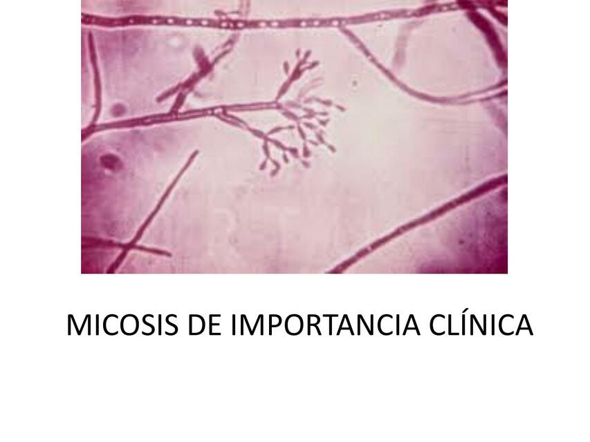 Micosis de importancia clínica | ROMINA FLORES | uDocz