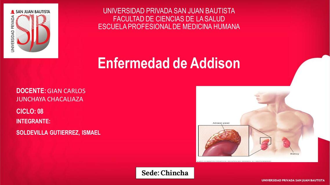 Enfermedad de Addison | ismael soldevilla | uDocz