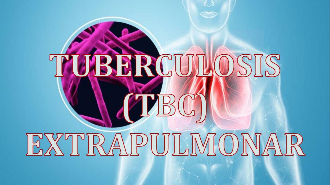 Tuberculosis extrapulmonar | Mishelle Chavez | uDocz
