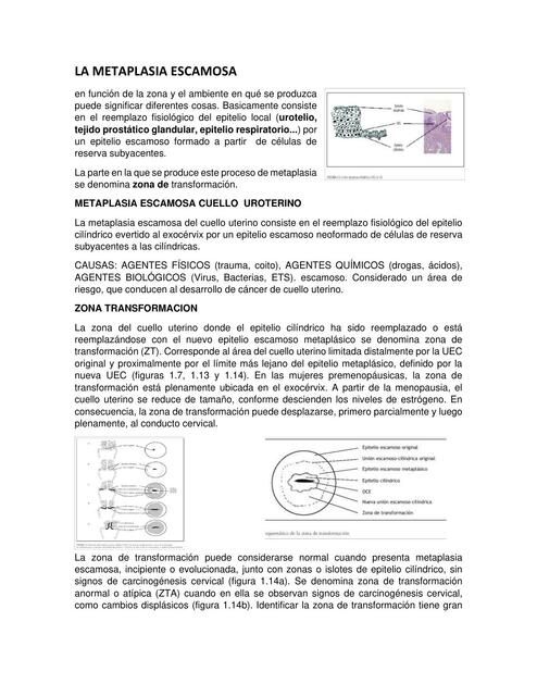 La Metaplasia Escamosa | Karlos Siv | uDocz