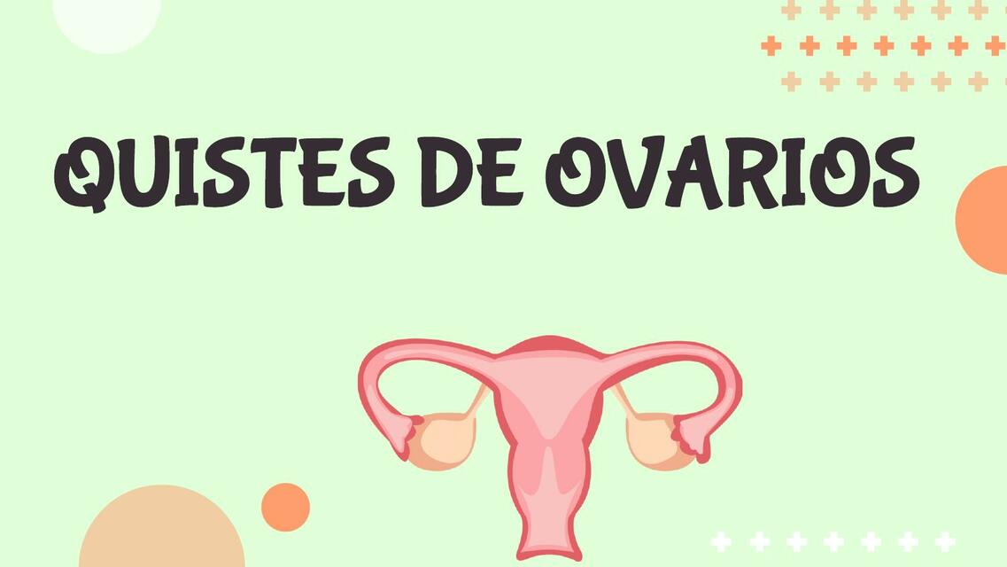 Quistes de ovarios | Lupita | uDocz