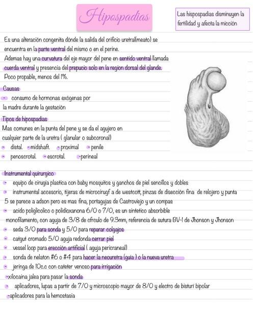 Hispospadias | laurav98o | uDocz