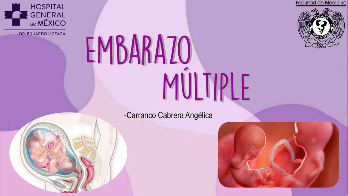 Embarazo Múltiple | Angélica Carranco | uDocz