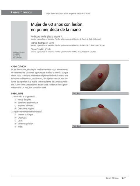 Mujer de 60 Años con Lesión en Primer Dedo de la Mano | YESICA QUENTA ...