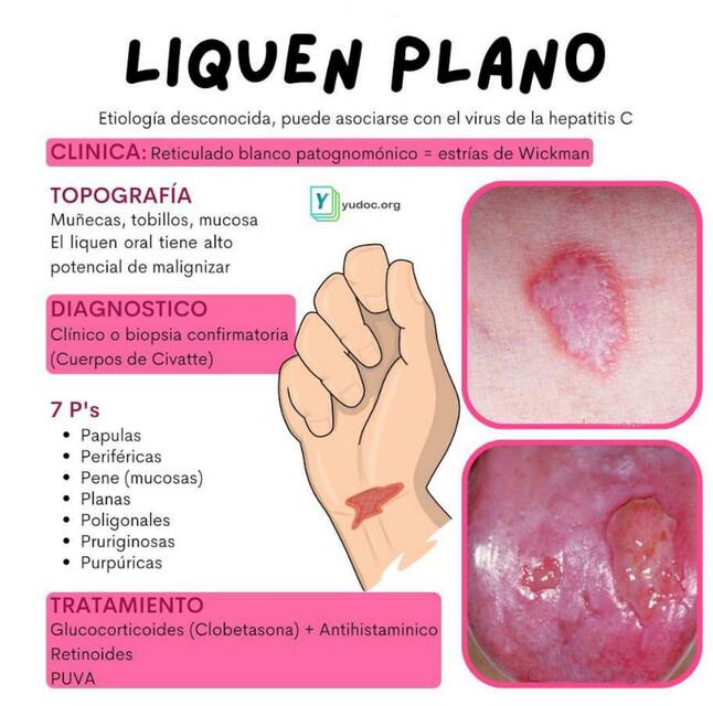 Linquen Plano | YUDOC.ORG | uDocz