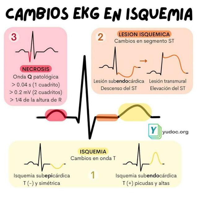 Cambios de Isquemias | YUDOC.ORG | uDocz