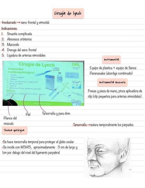 Cirugía de lynch | laurav98o | uDocz
